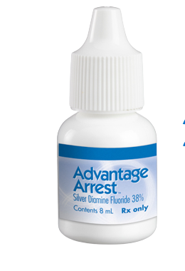 Silver Diamine Fluoride (SDF) Application